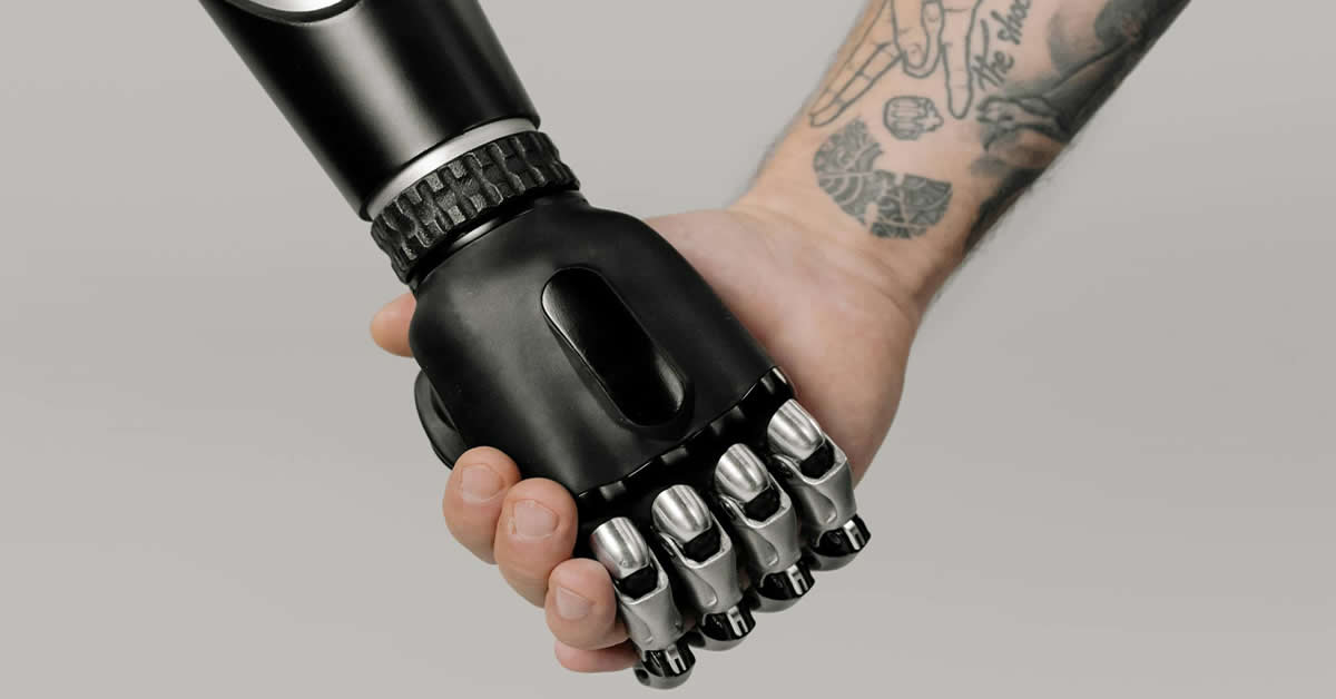 Robotic Joint Replacement - Adam Gaunt